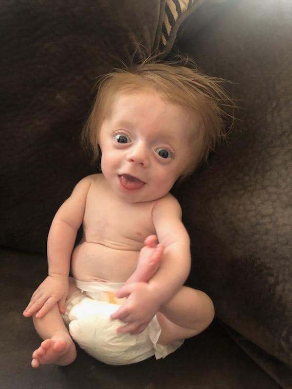 Newborn Diagnosed With Brittle Bone Disease Defies All Odds Inner Newborn Diagnosed With Brittle Bone Disease Defies All Odds Inner